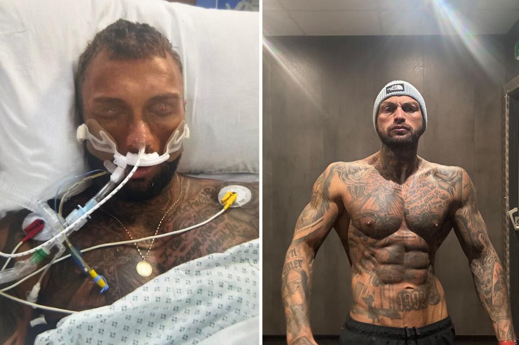 32-Year-Old British Bodybuilder Zak Wilkinson Left in Coma With Brain ...