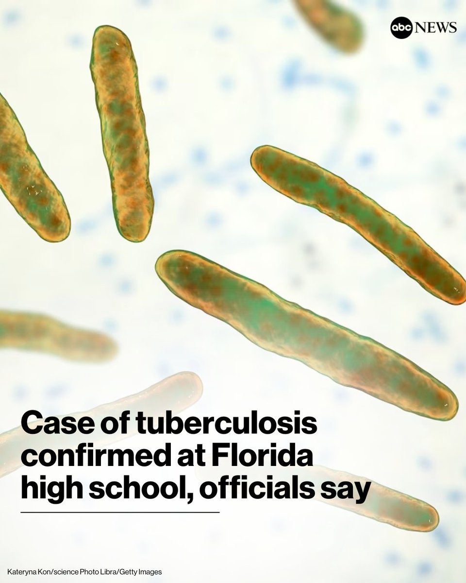 Active Tuberculosis Case Confirmed in Student at Dillard High School ...
