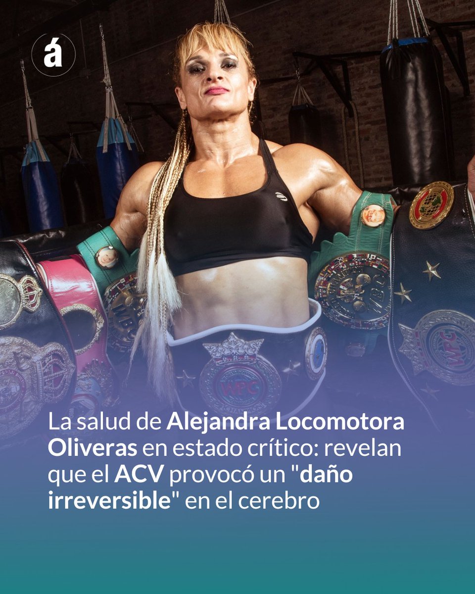 Alejandra "Locomotora" Oliveras Dies at 47 After Ischemic Stroke ...