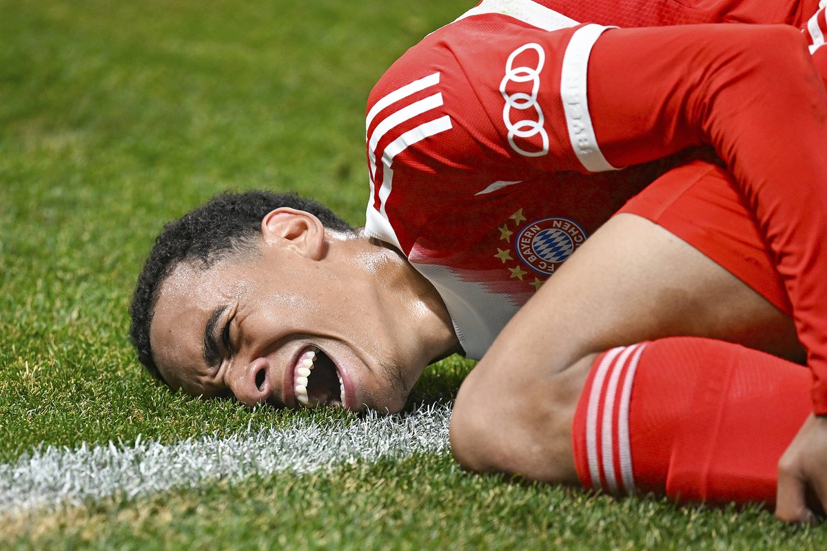 Bayern’s Musiala Breaks Fibula in Club World Cup, Faces Five-Month ...