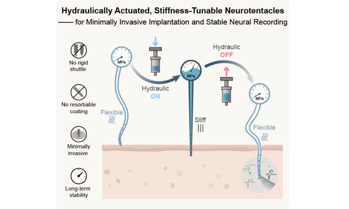 Brain Implant Decodes Inner Speech, Restores Voice to Stroke Patient ...