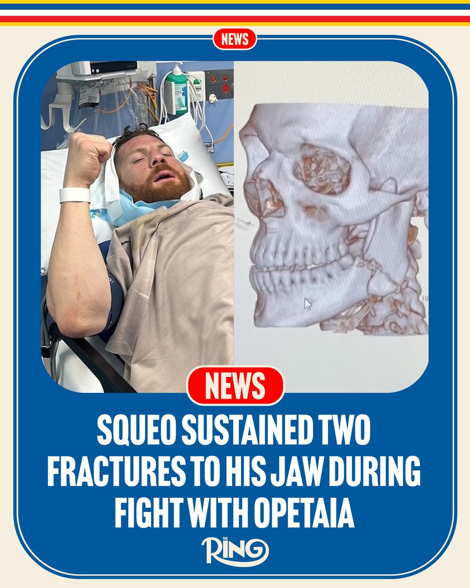 Claudio Squeo Undergoes Successful Surgery for Two Jaw Fractures After ...