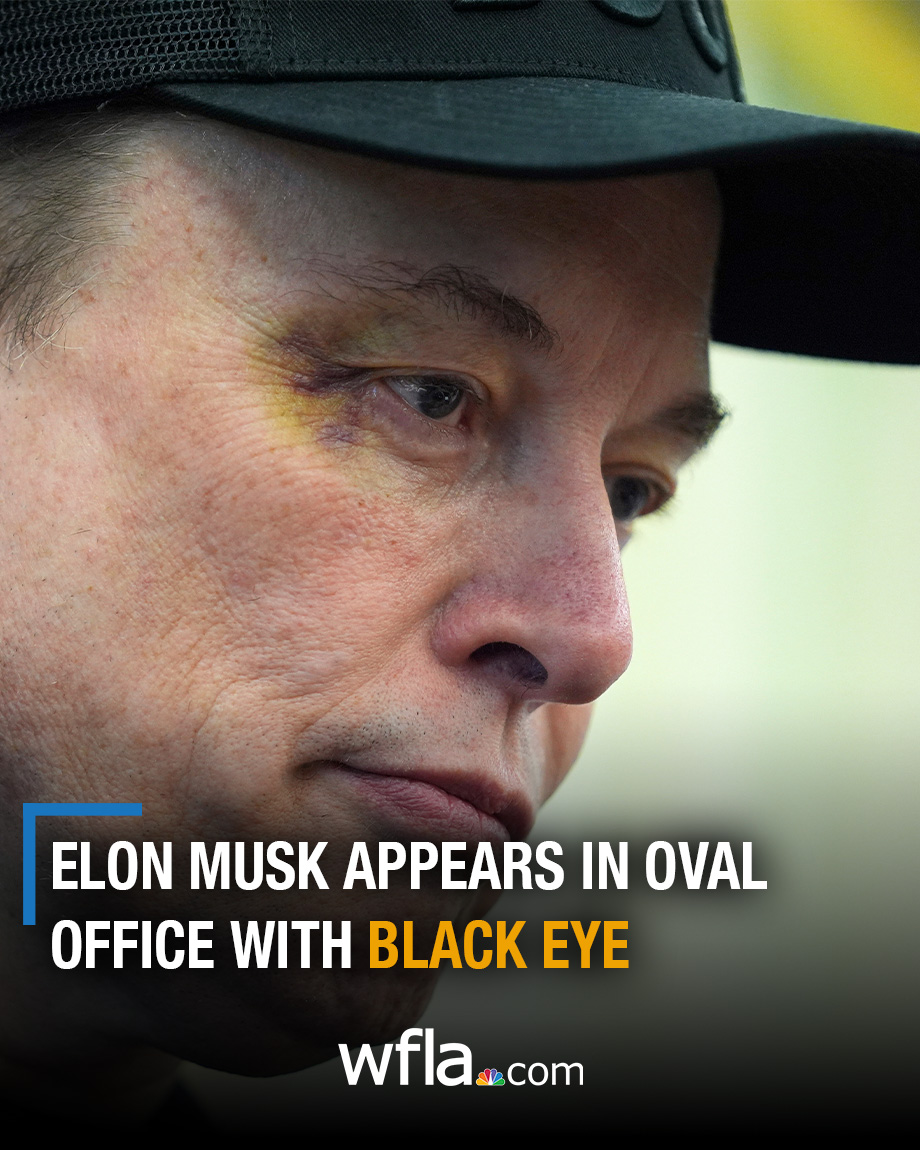 Elon Musk's Black Eye at White House Farewell Explained: Playful Punch ...