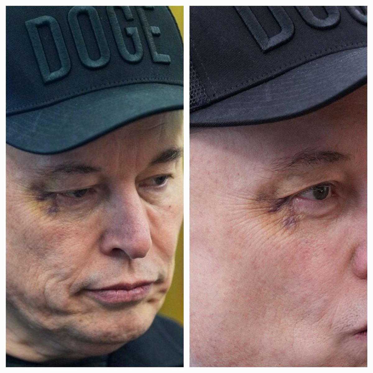 Elon Musk Says Black Eye at White House Farewell Came from Playful ...