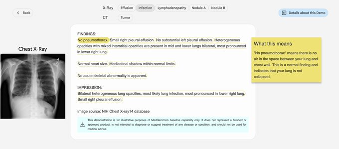 Google DeepMind Launches MedGemma With 4B Multimodal and 27B Text Models in Health AI Developer ...