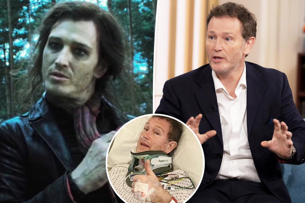 Harry Potter Actor Nick Moran in Intensive Care After Emergency Spinal ...