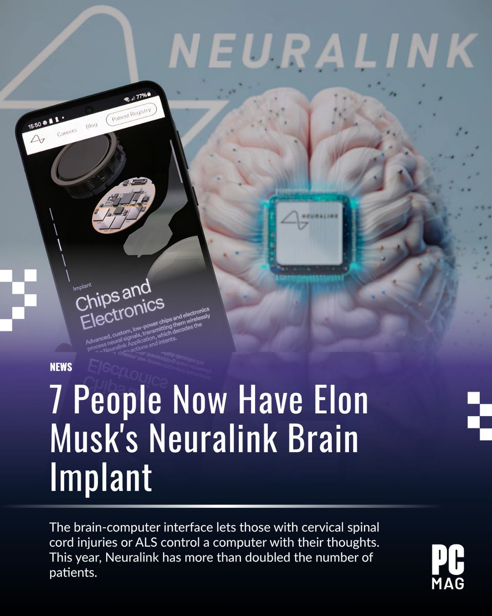 Neuralink Implants Telepathy Brain Chip in Seven Humans, Gains Trial ...