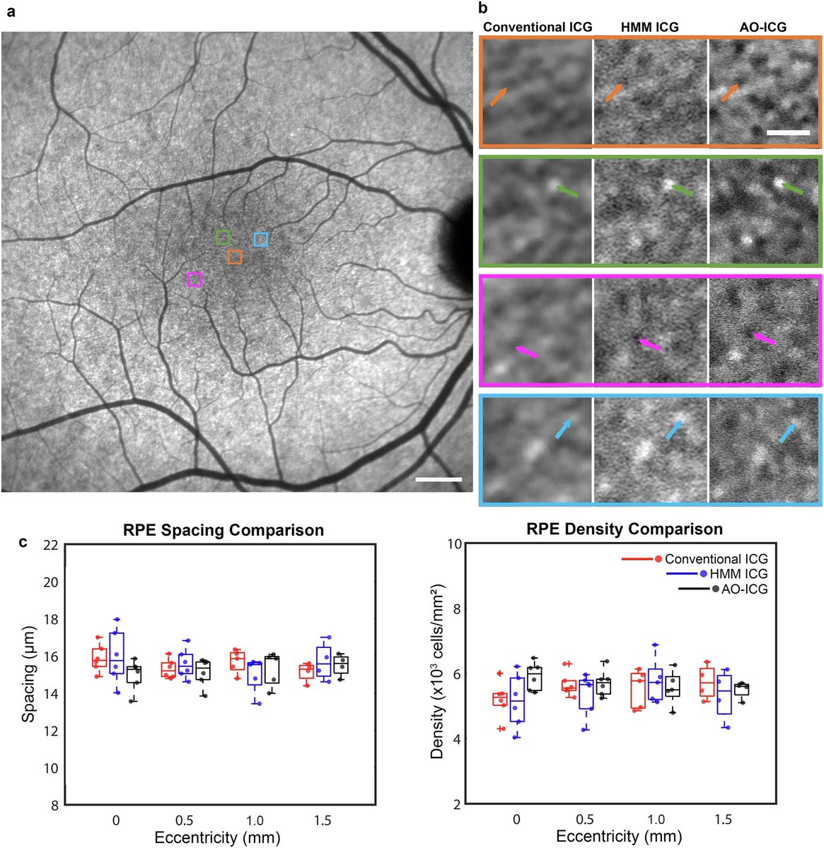 NIH Researchers Use AI for Cellular-Level Retinal Imaging; Drug and ...
