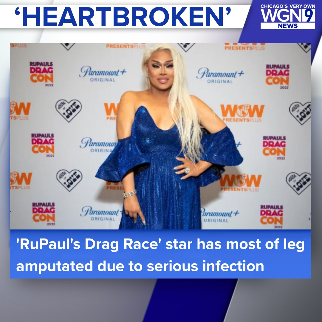 RuPaul's Drag Race Star Bianca Castro Dies Days After Right Leg ...
