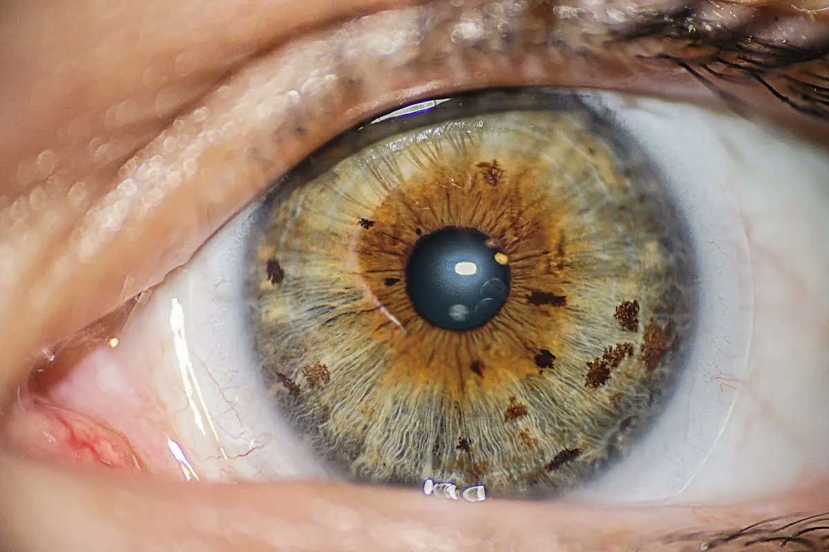 Scientists Discover New Color, Advance Retinal Therapy with Gold ...
