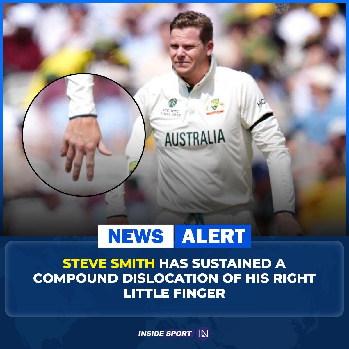 Steve Smith Suffers Compound Dislocation of Right Little Finger in WTC ...