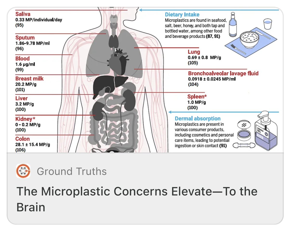 Studies Reveal Microplastics Accumulate in Human Brains, Estimated at ...