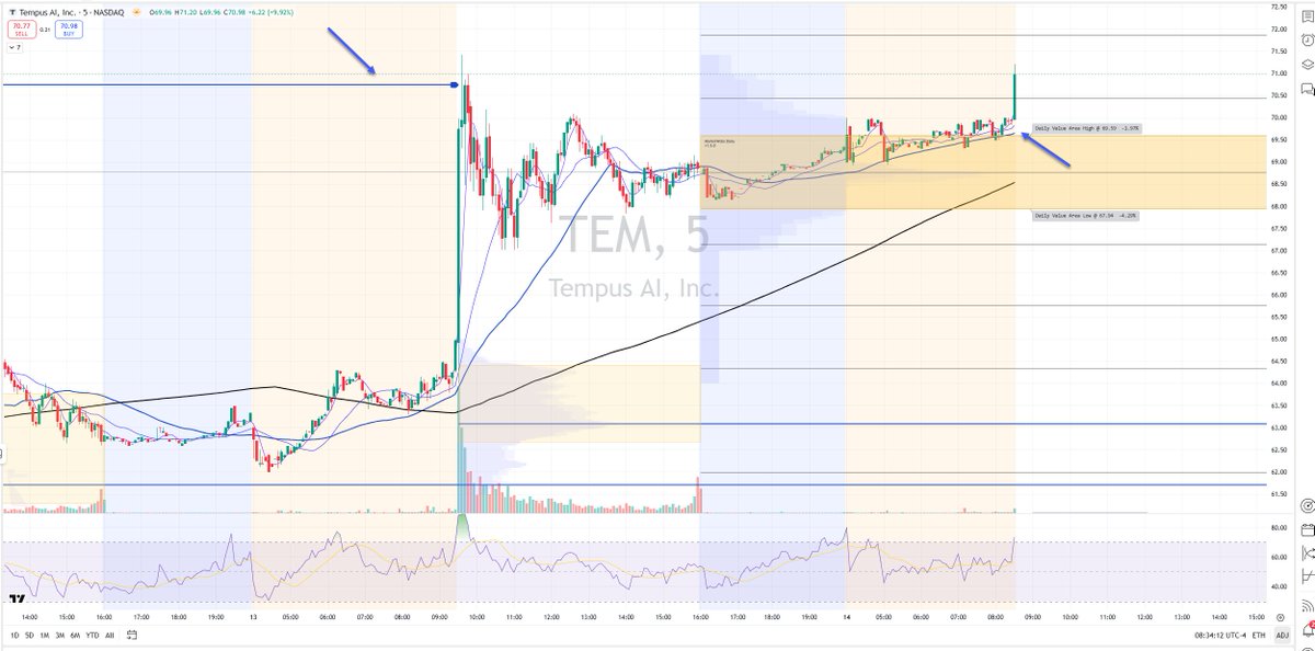 Tempus AI (TEM) Shares Rise 2.5%-3.0% on Multi-Year Collaboration With ...